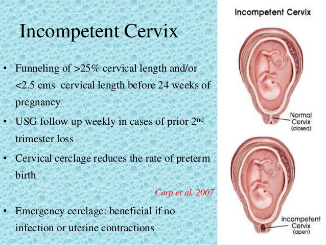7 MOST COMMON CAUSES OF SINGLE AND RECURRENT MISCARRIAGE. | SMART Patients