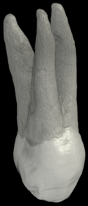 The Root Canal Anatomy Project: Maxillary First Premolar