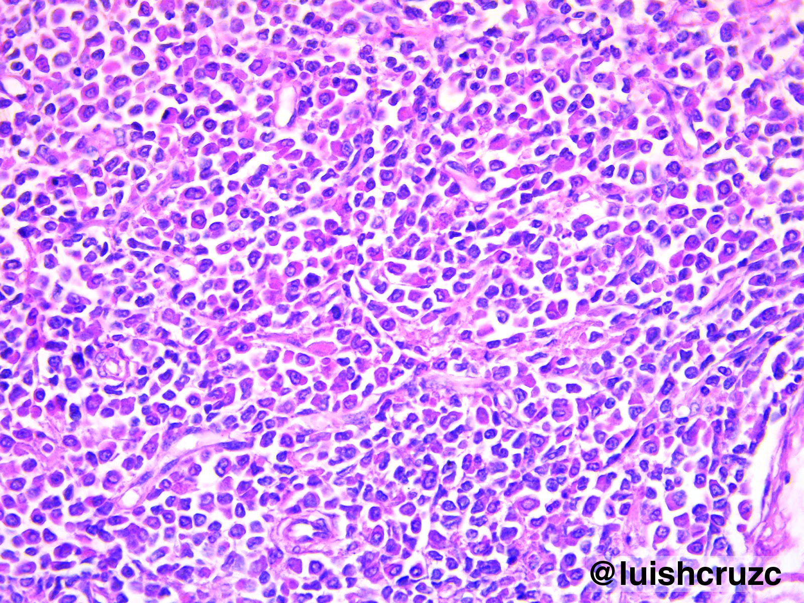 Patología CC: diciembre 2014