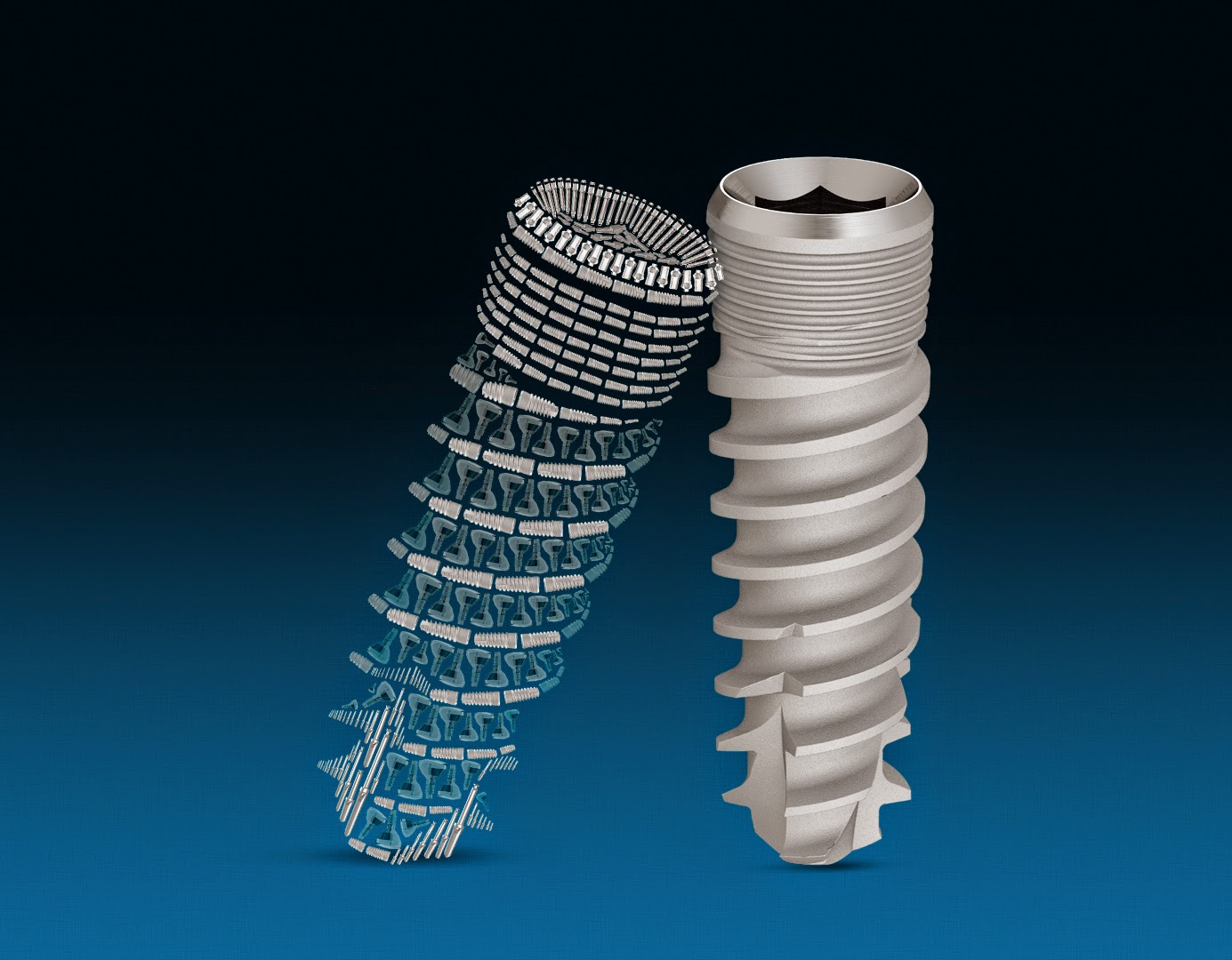 Mis Implants Colombia: Implantes dentales - Implante SEVEN MIS