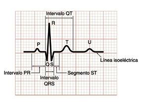 Novedades Enfermeria: Componentes del trazo de un ECG