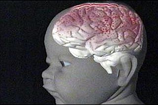 Attempra: El daño cerebral en prematuros se detectará antes del año de vida