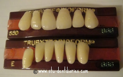 Stu-DENT Diaries: Setting Maxillary Anterior Teeth