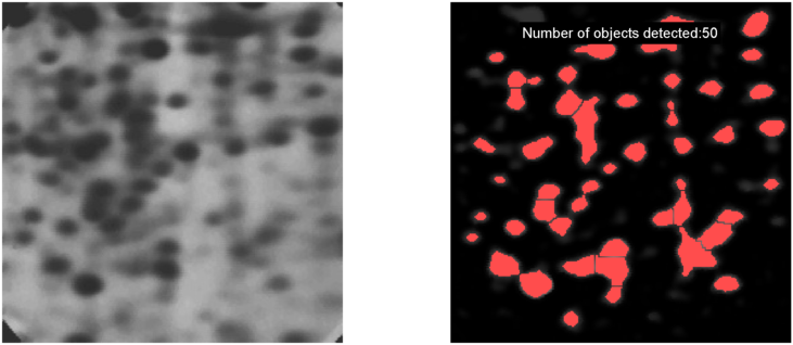 Basic Cell Counting And Segmentation In Matlab