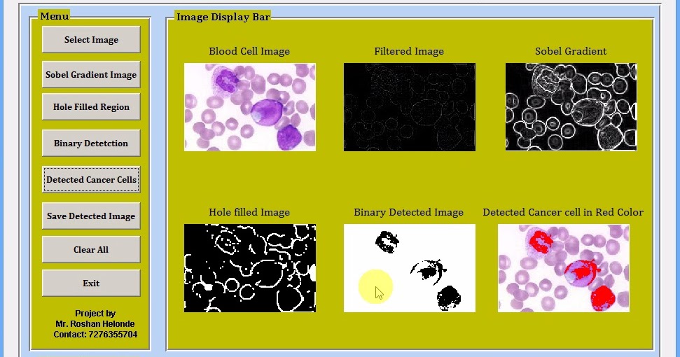 Blood / Leukemia Cancer Detection Using Image Processing Matlab Project Code || IEEE Based ...