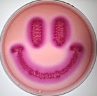 Hydrogen Sulfide (H2S) Production Test - Microbiology Lab Notes