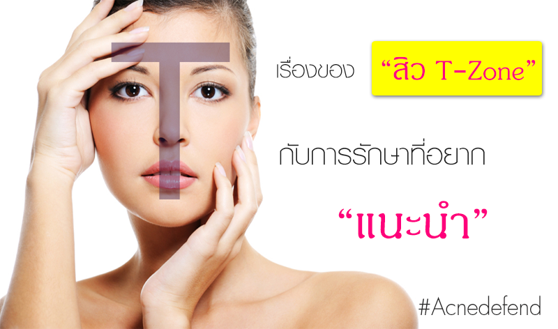 มารักษาสิวทีโซน (T-Zone) กันเถอะ สิวยอดฮิตของคนเป็นสิว ที่เป็นง่ายดาย ...