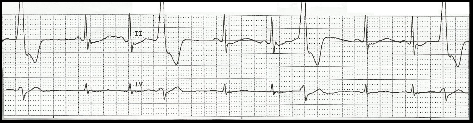 Basic EKG Rhythm Test 08