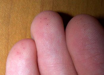 Your Diabetes May Vary: #TwoBits - It makes dots on Mikey