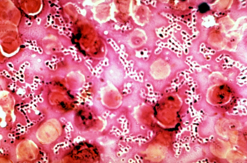 STREPTOCOCCUS PNEUMONIAE "PNEUMOCOCCUS" | All Microbes