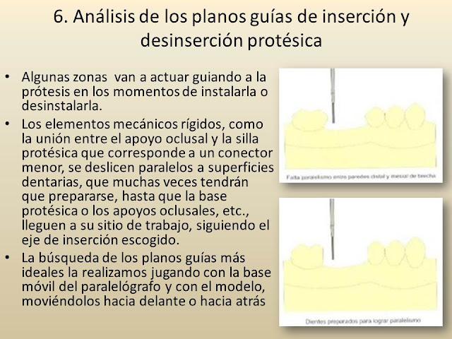 REHABILITACIÓN II: El paralelógrafo y su uso para la selección del ...