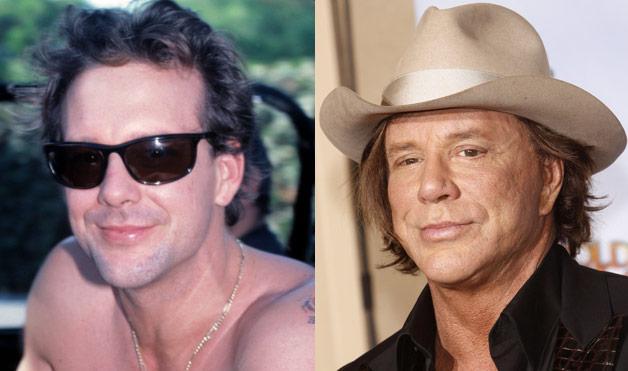 Celebrity Plastic Surgery Gone Wrong