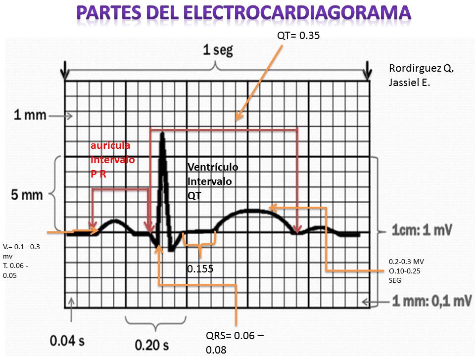 Materia de Fisiologia: Electrocardiograma
