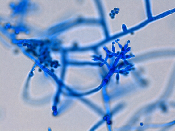 Fun With Microbiology (What's Buggin' You?): Trichoderma species