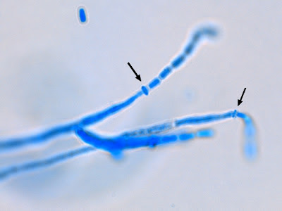 Fun With Microbiology (What's Buggin' You?): Arthrographis species