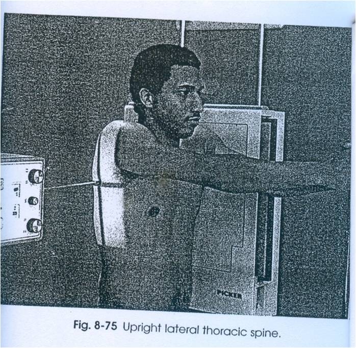 TEKNIK RADIOGRAFI THORACAL: TEKNIK RADIOGRAFI THORACAL