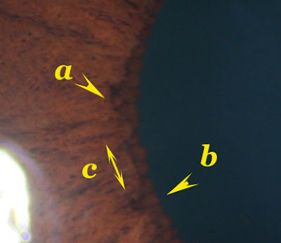 Modern & Multidimensional Iridology: Micro View in Inner Pupillary ...