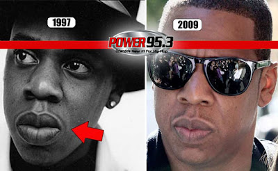 Jay Z Plastic Surgery Before and After Breast Implants and nose Job ...