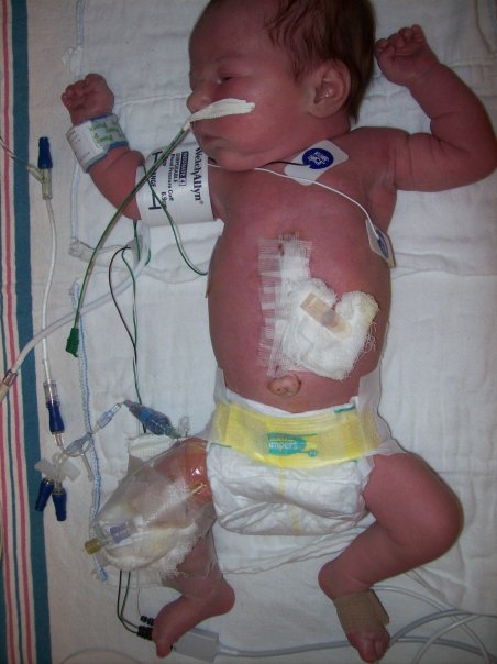 Working on a Full House: Managing a NICU Baby with Children at Home AND ...