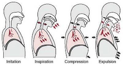 Cough - Definition and Mechanisms | Procedure, Treatment and Therapy