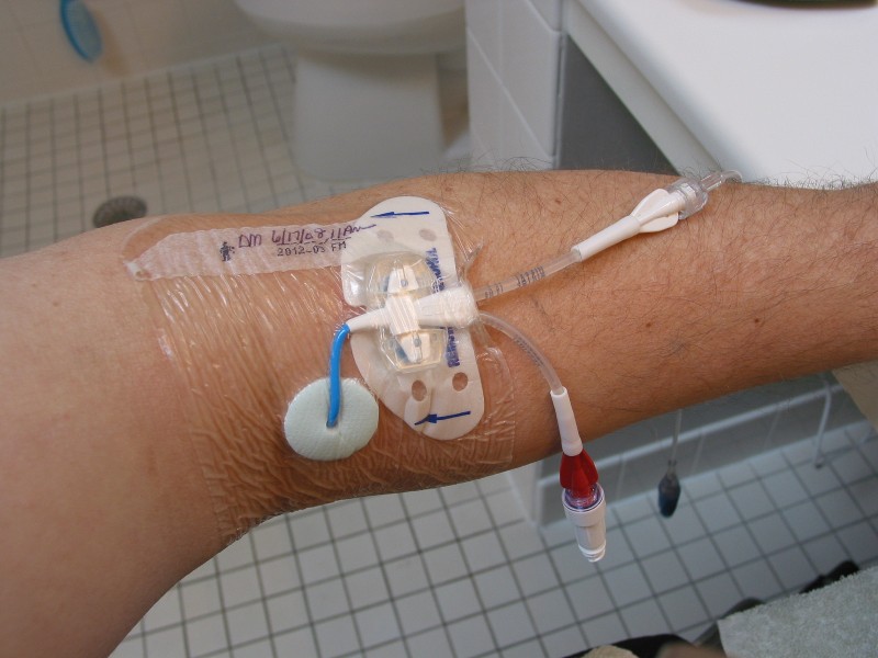 Picc Infected masuk pulak Chemoport.. | Tunggu ,, Ini Semua Poyooo