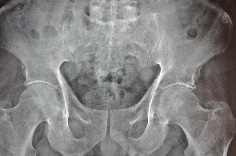 EL RINCÓN DE LA MEDICINA INTERNA. juanpedromacaluso@yahoo.com.ar: VARÓN ...