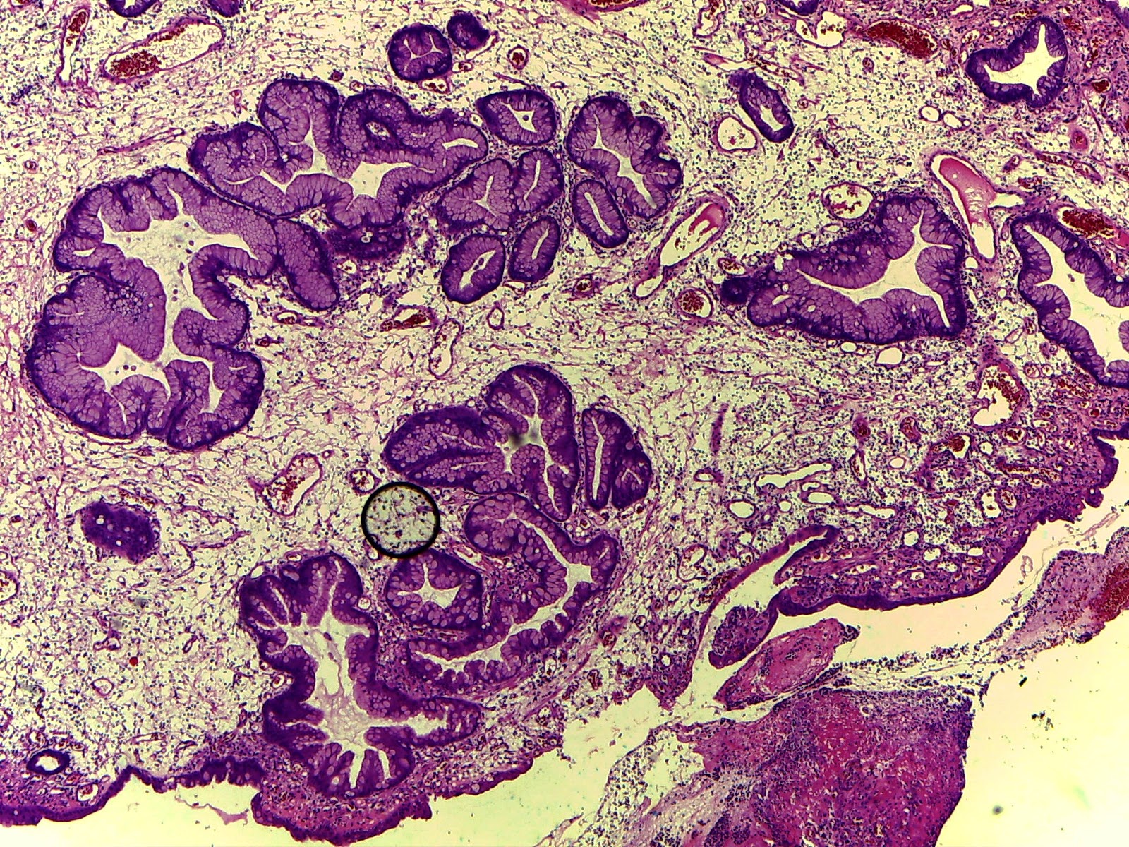 GASTROINTESTINAL AND LIVER HISTOLOGY PATHOLOGY ATLAS: STOMACH ...