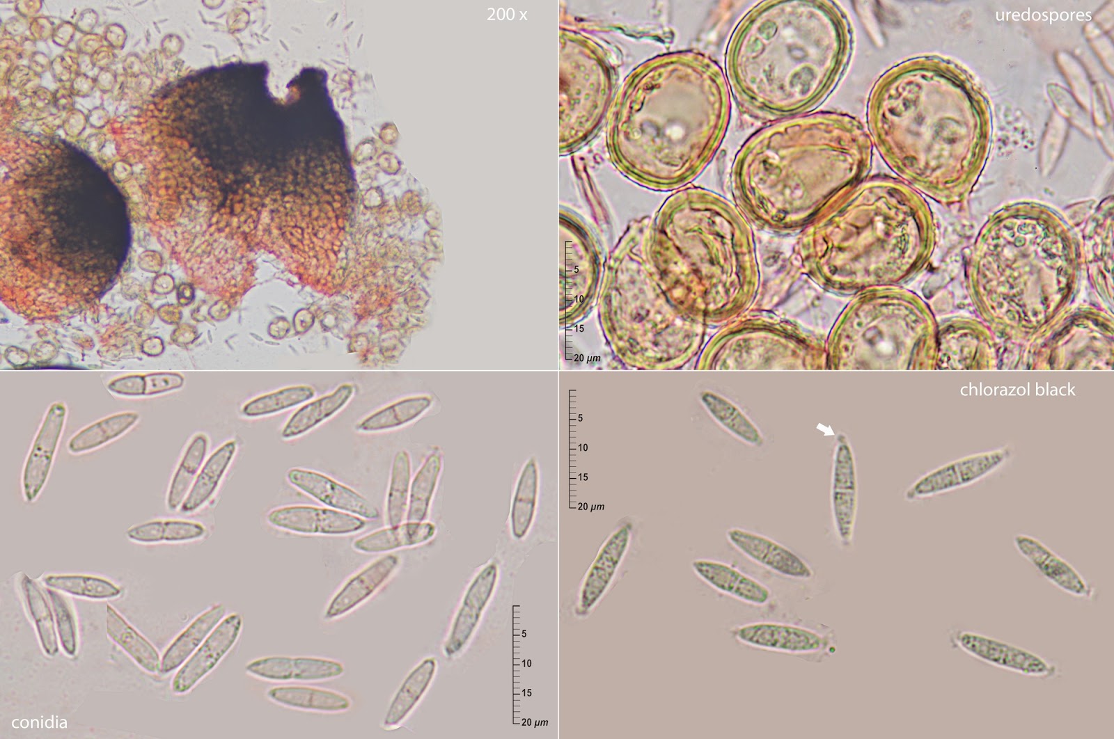 Sphaerellopsis filum (Biv.) B. Sutton