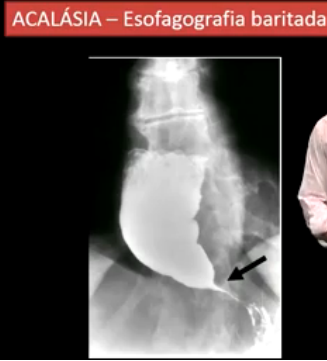 Resumidão Med: Cirurgia Geral