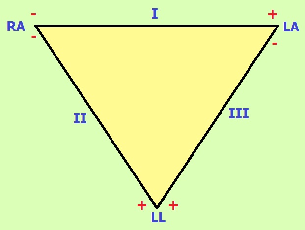 Easy Tips - Einthoven's Triangle