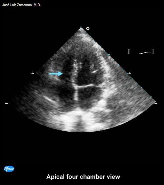 Echocardiography (USG Jantung)