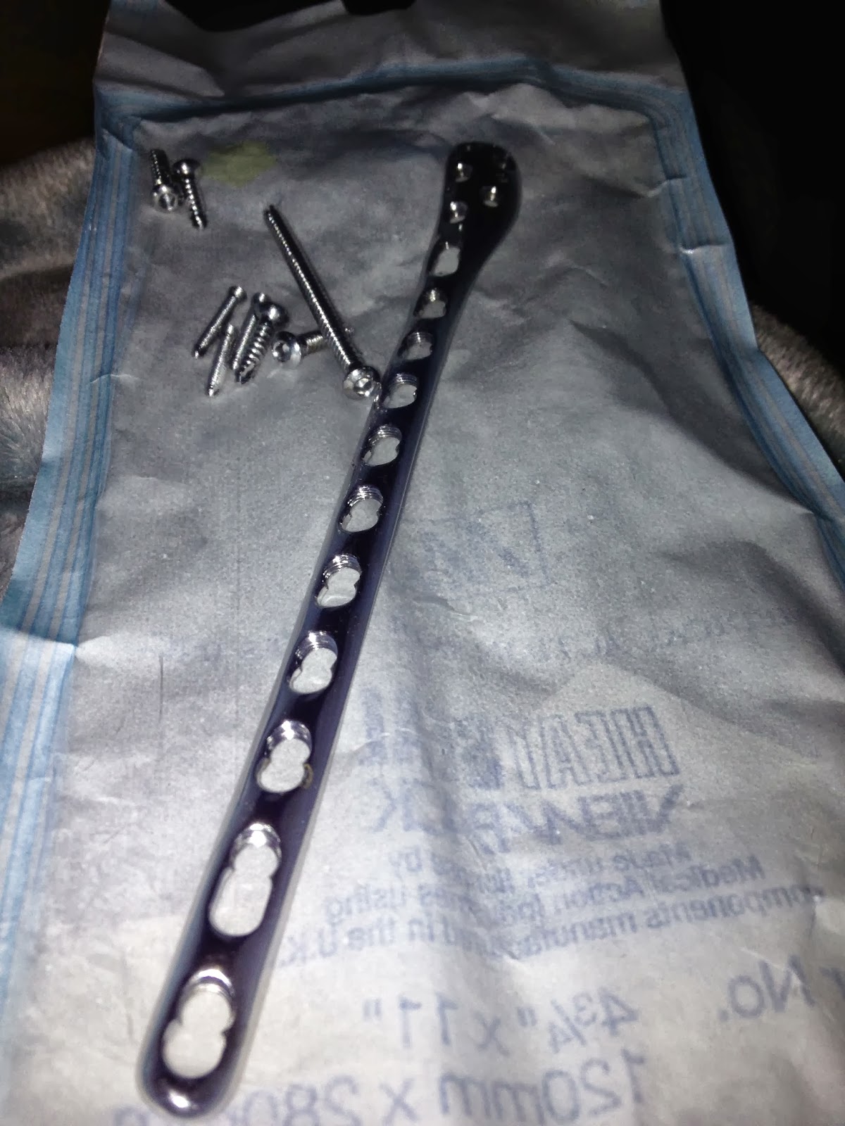 My Broken Ankle Journey: Hardware removal...be gone you nasty infection ...