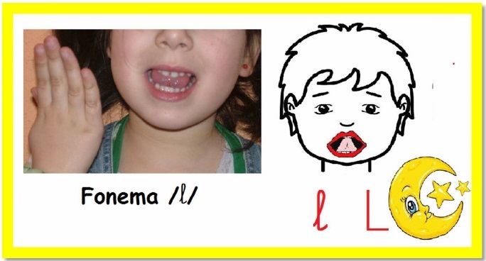Mi Rinconcito de Apoyo: Asociando fonemas 2: /L/ - /R/