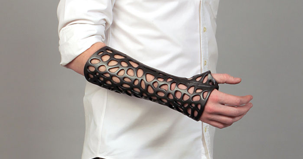 This Futuristic 3D-Printed Cast Will Heal Your Bones 80% Faster - Wise ...