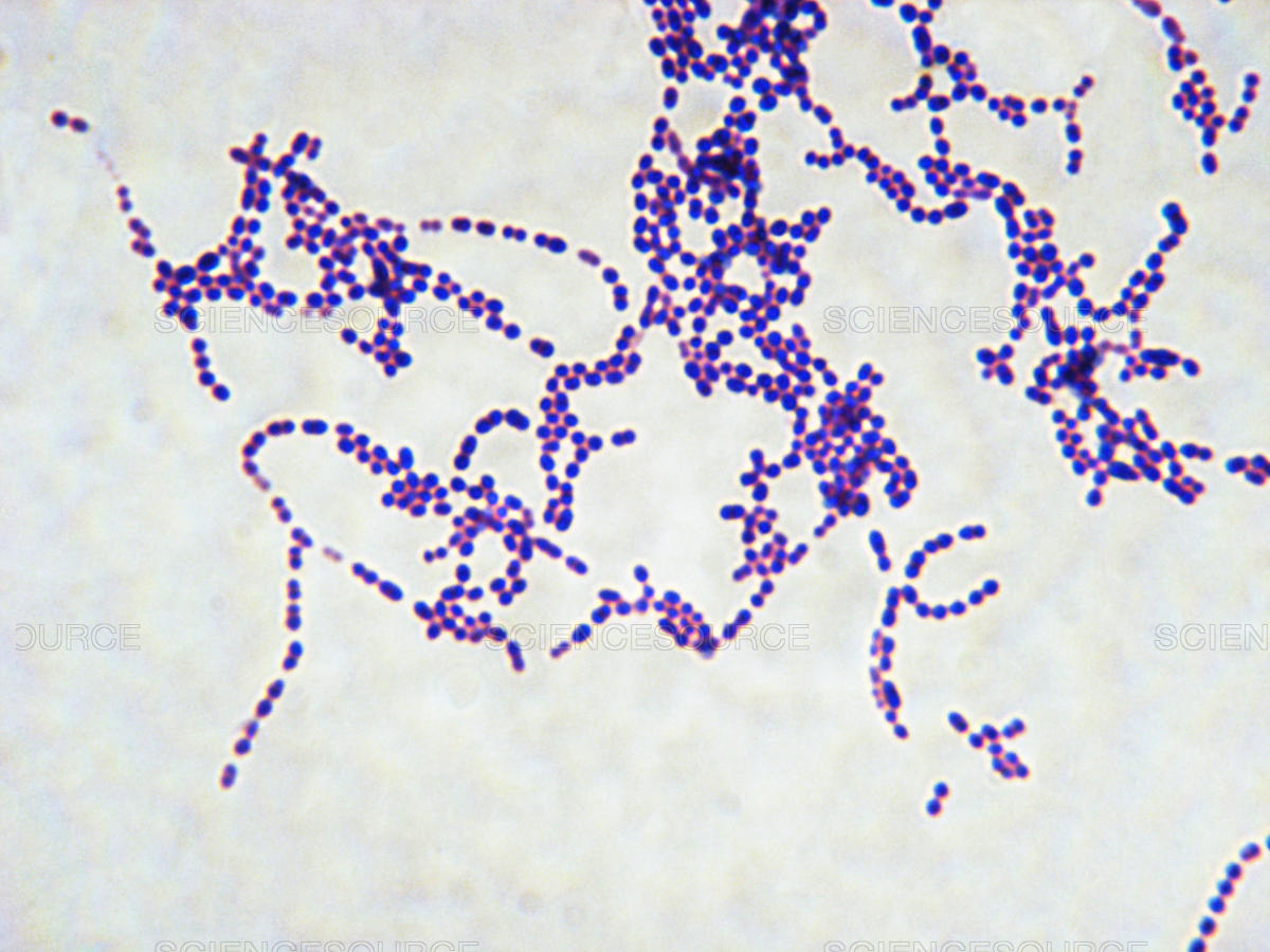 Streptococcus (Streptokoklar) - Microbiology Laboratory Turkey