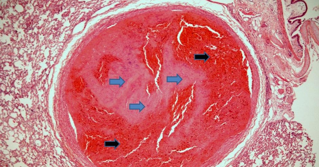 Laboratório Virtual de Patologia/Virtual Laboratory of Pathology ...