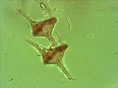 Laboratorio de Plancton: plancton