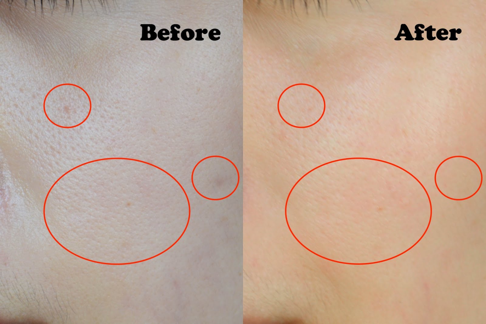 |REVIEW| Zephyrine Starter Pack: After Using It for One Month