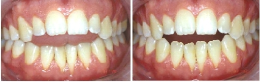 Day 28: The Mighty Tongue - Queen of Dental Hygiene