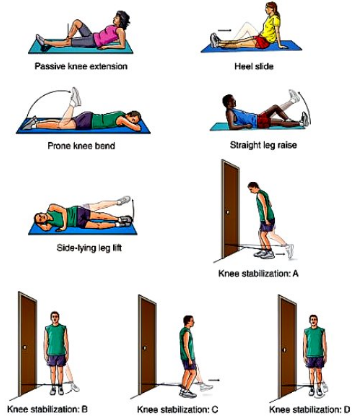 Accelerated ACL Reconstruction Rehabilitation Program - webbooz