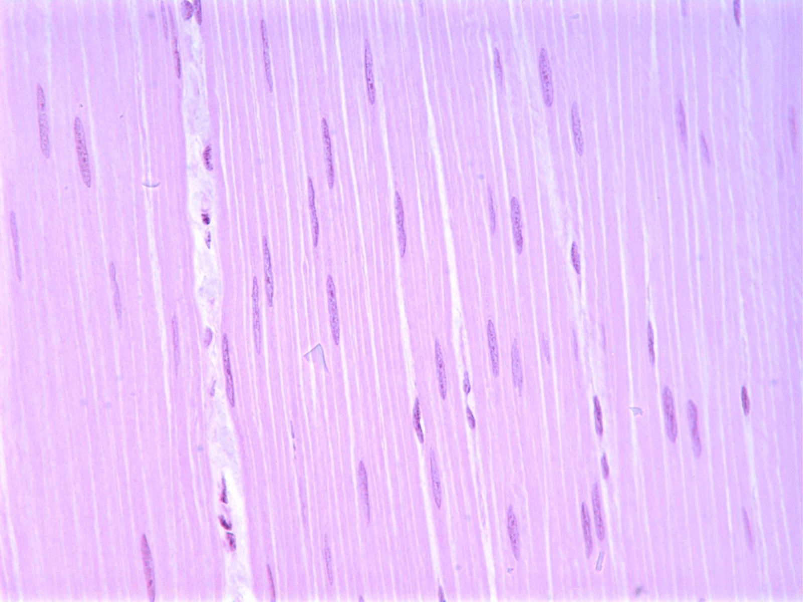Histología en Imágenes : TEJIDO MUSCULAR LISO