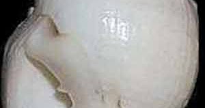 Different Types of Conch – Shankh – in Hinduism – Benefits | Hindu Blog