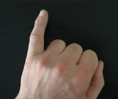 #74 Rahasia Dibalik Kedutan Jari Kelingking Tangan Kiri - RAHASIA KEDUTAN