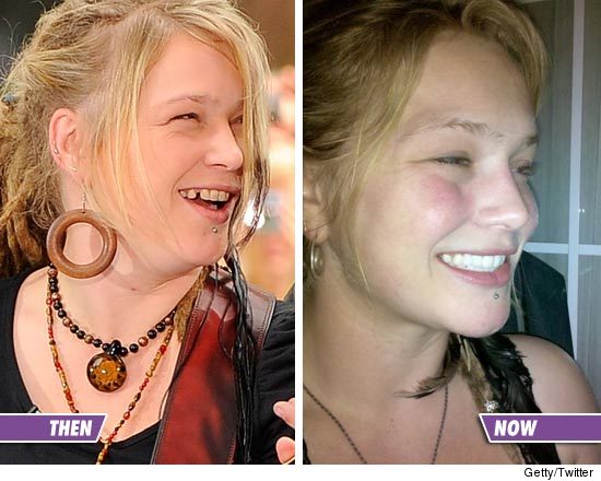 Crystal Bowersox Plastic Surgery Before and Afer Breast Implants and ...