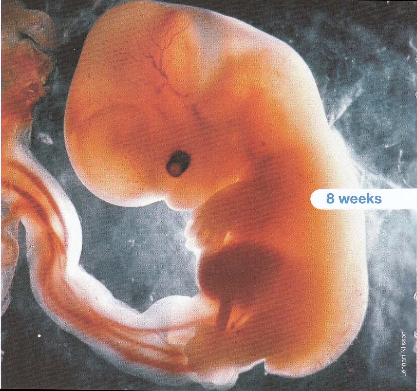 For Grace Noel: My Story - The Abortion