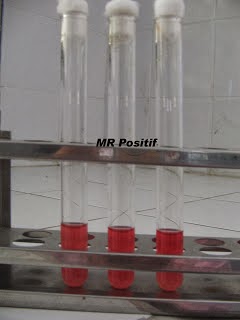 Medicolicious: Uji Biokimia Bakteri