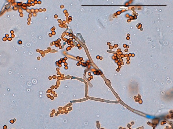 Fun With Microbiology (What's Buggin' You?): Cladosporium species ...