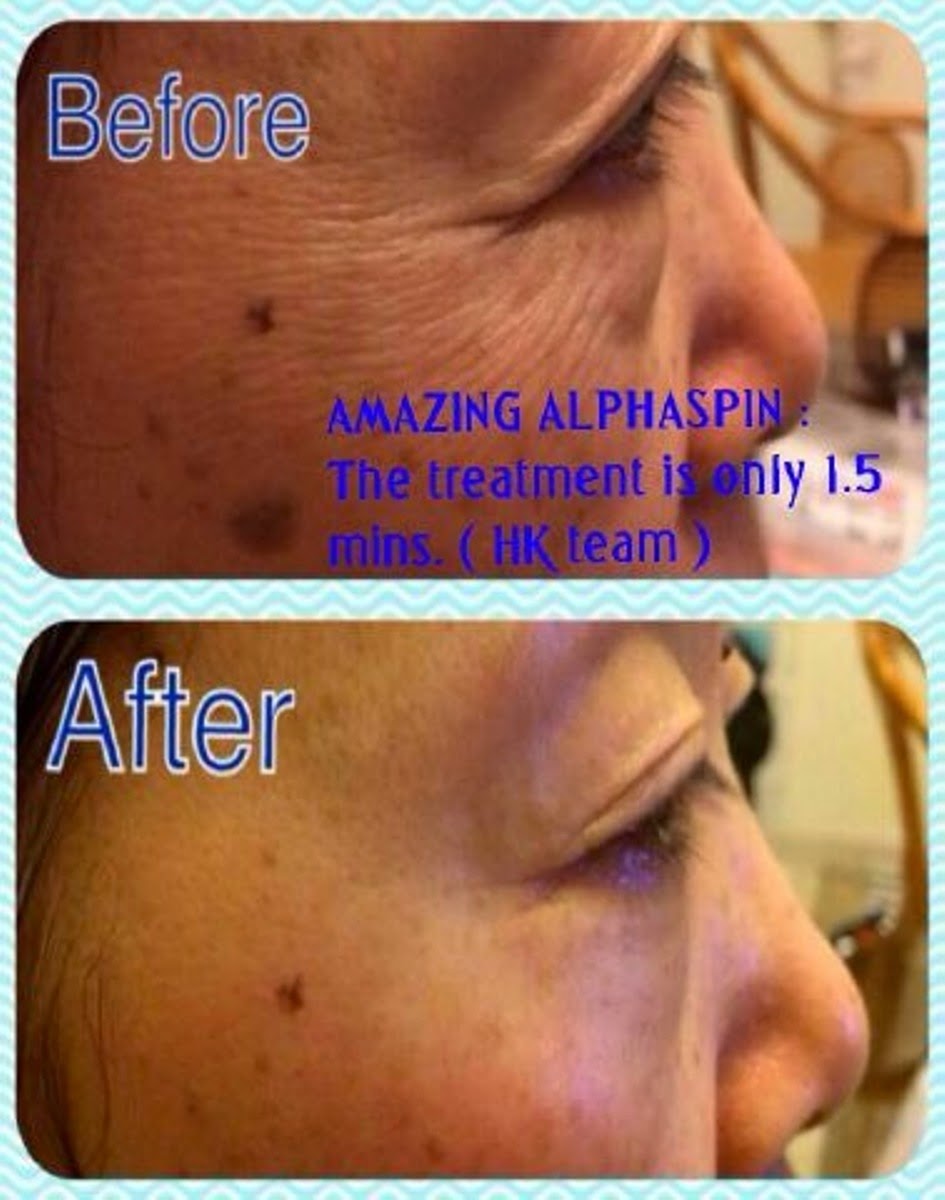 Alphaspin have many benefit for whole family.Testimony user see below ...