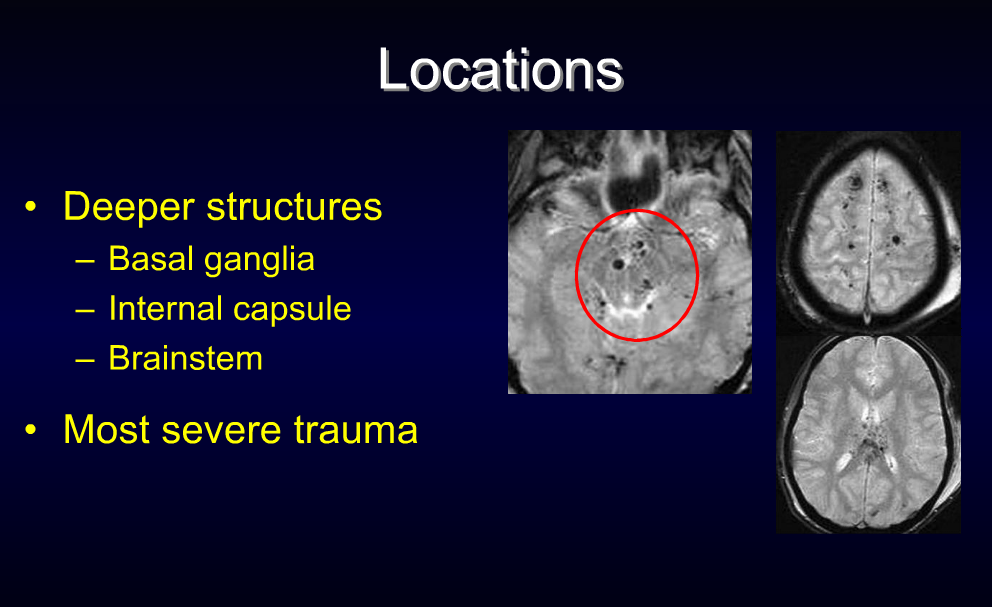 rsna: emergency neuroradiology: 한번더
