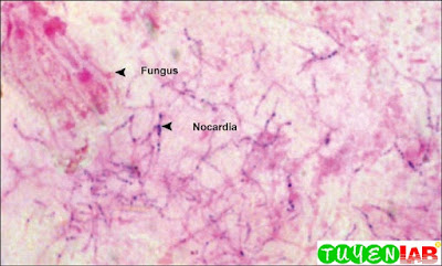 Staining Procedure for Rapid Identification of Fungi | Free Medical Atlas